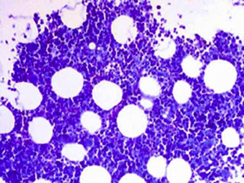 Giemsa – Dana Bioscience